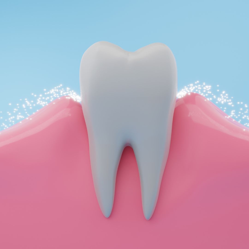 ¿Qué es el sarro dental? - Tratamientos